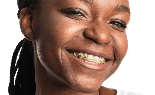 Gold Braces | Augusta Orthodontic Free Online Consultation